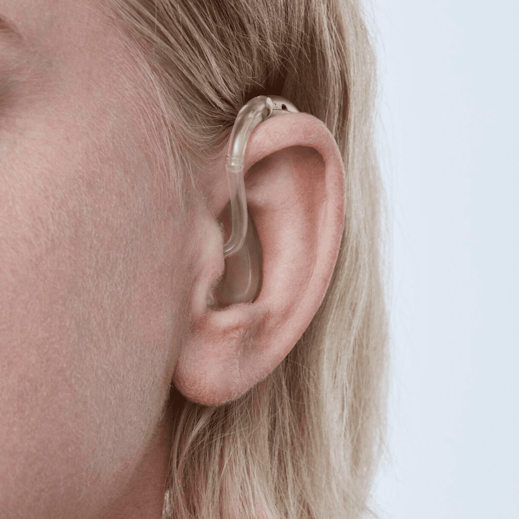 Oticon Xceed - Telex