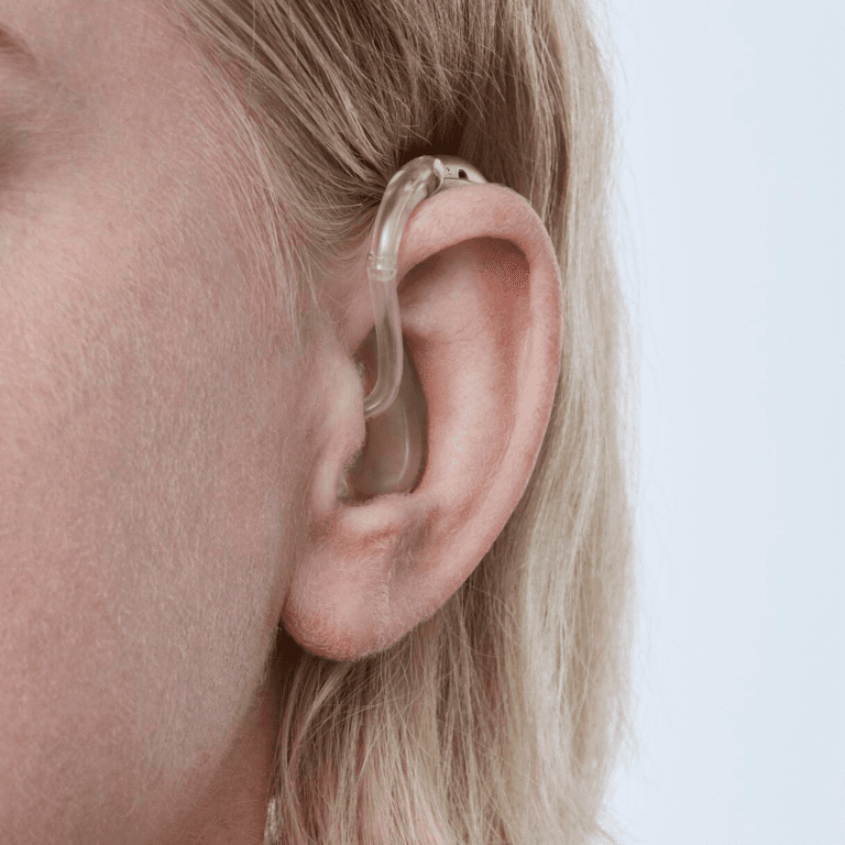 Oticon Xceed - Telex